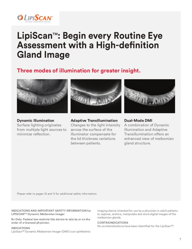 Johnson & Johnson Vision – Lipiflow and Lipiscan – Dry Eye Practice ...